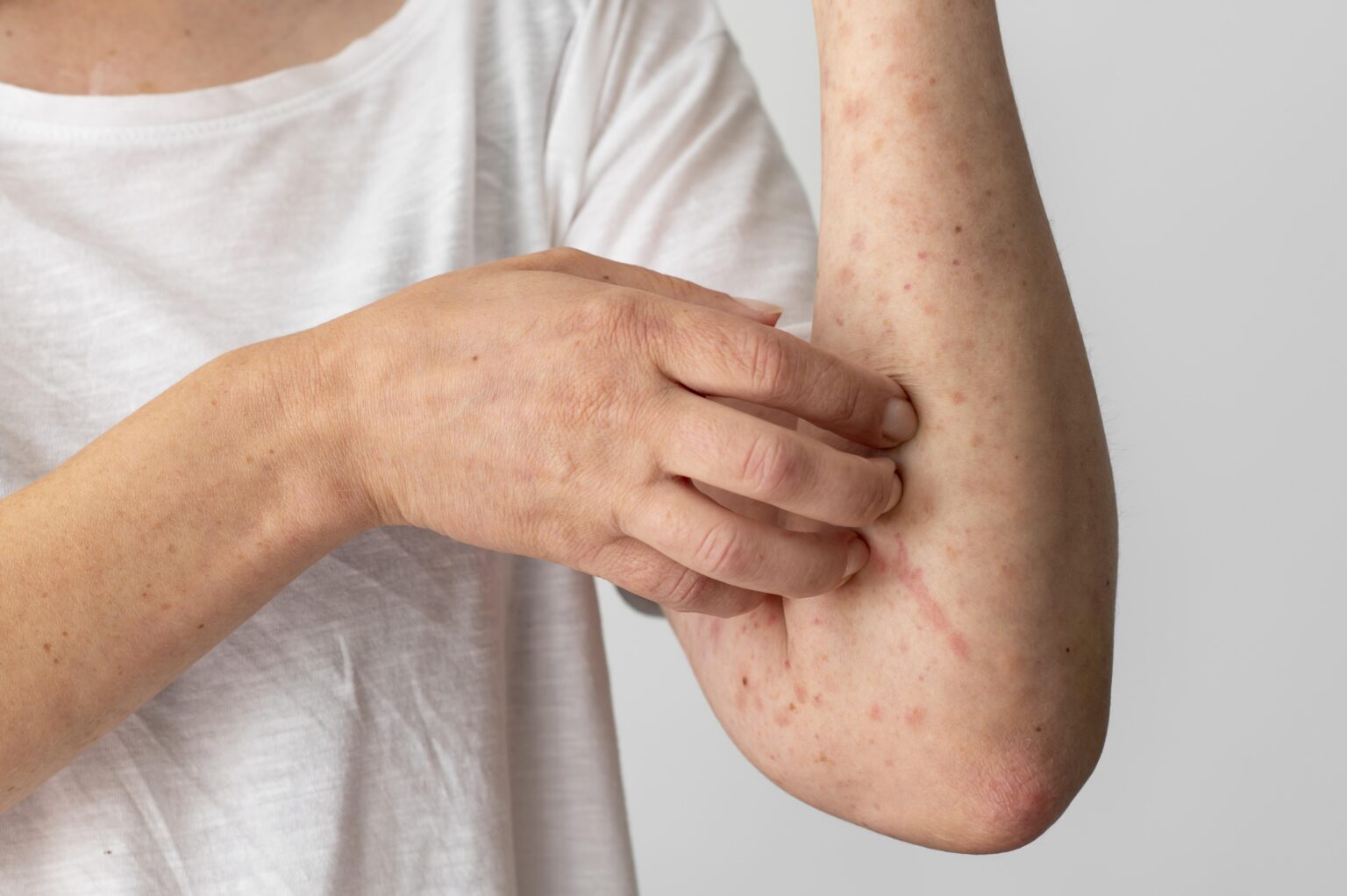Understanding Allergies: Causes, Symptoms, and Management - CONALT